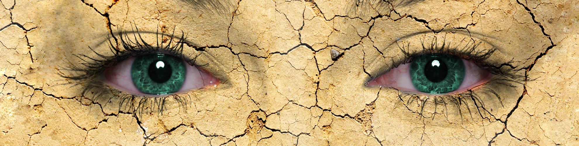 Dry Eye Syndrome - Davison Vision Center